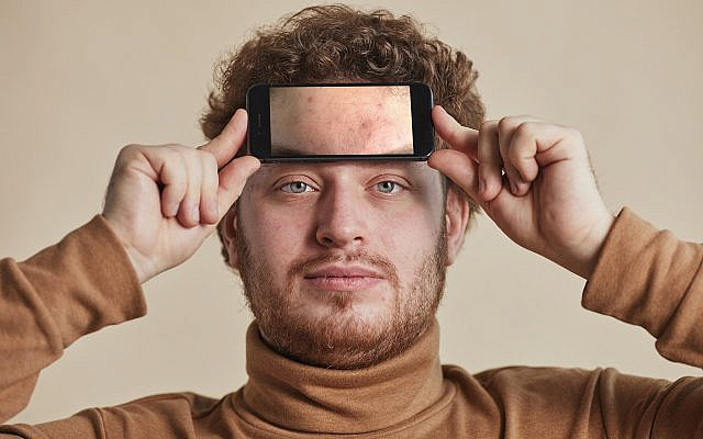 The Blogs: Funny foreheads | Reuven Chaim Klein | The Times of Israel