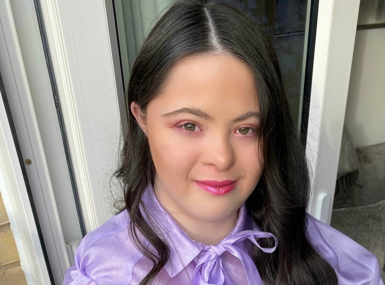 How a 21-year-old UK model with Down syndrome became a global face for ...